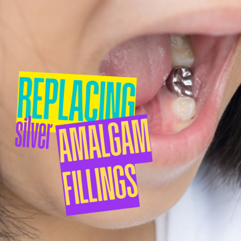 Replacing Silver Amalgam Fillings - Cherry Hill Dentistry